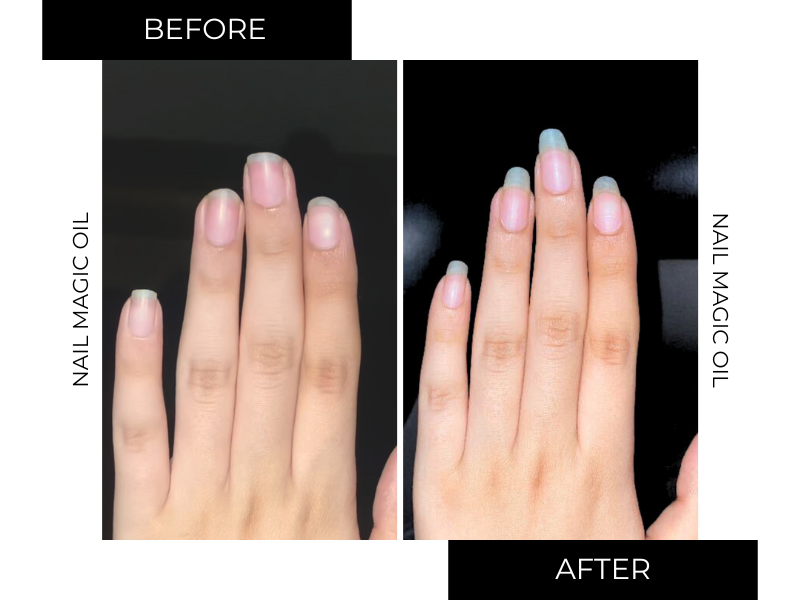 Magic Transformation Kit (1 Nail Oil + 1 Serum) – DEOC Cosmetics